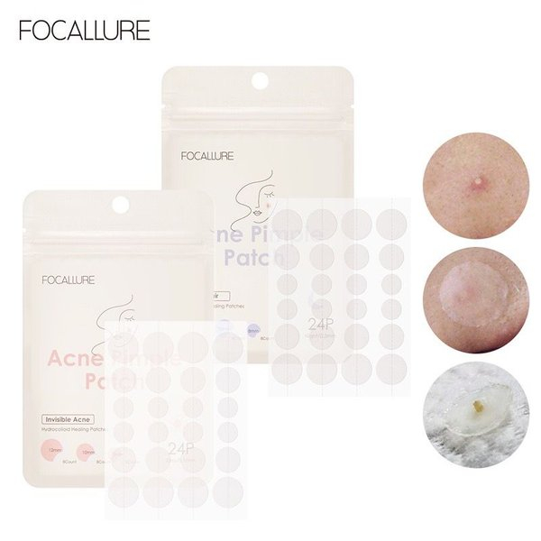Jual FOCALLURE Spot Patch Acne Treatment Day/Night | Shopee Indonesia