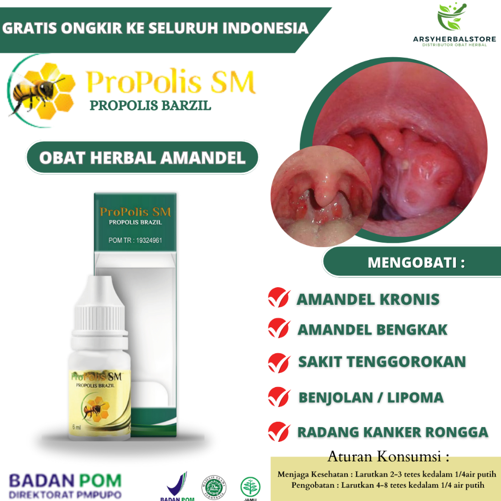 Jual Obat Amandel Anak Dan Dewasa Penghancur Benjolan Di Langit Mulut Radang Tenggorokan, Nyeri ...