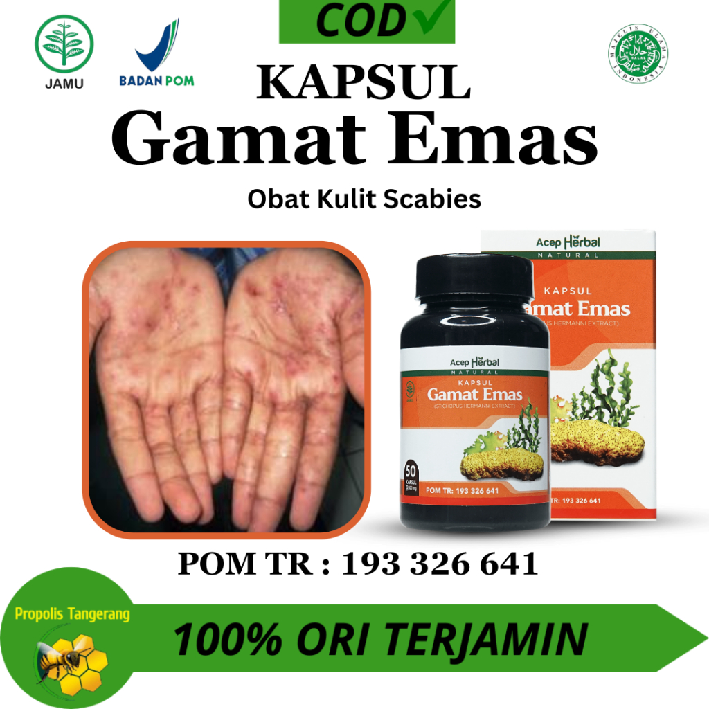 Jual Kapsul Gamat Emas 100% Original - Obat Kulit Scabies,Kulit Eksim ...