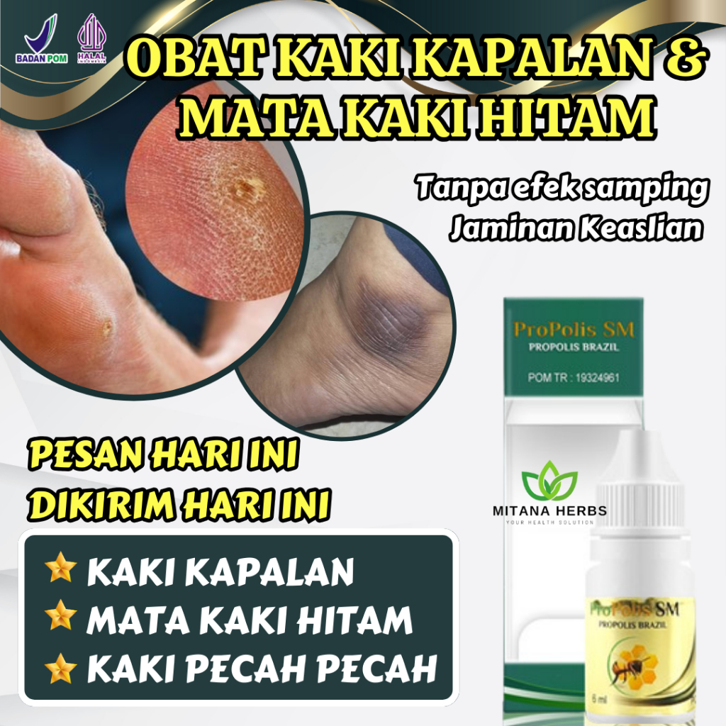 Jual Obat Mata Kaki Hitam - Obat Kaki Kapalan - Obat Kaki Pecah Pecah ...