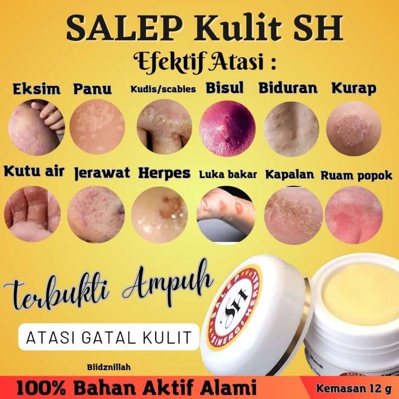 Jual Salep Kulit Sinergi Herbal | Shopee Indonesia