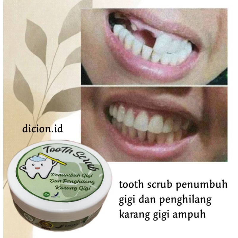 Jual PENUMBUH GIGI ALAMI - Gigi Ompong Tertambal Lagi // Gigi Patah ...