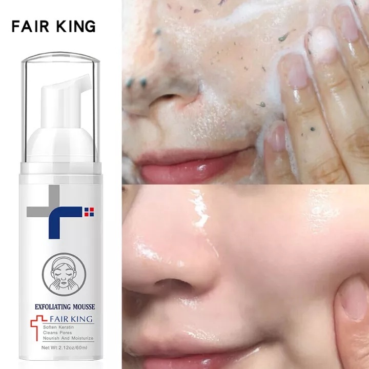 Jual FAIR KING Sabun Cuci Muka Wajah Exfoliating Mousse Peeling Gel ...