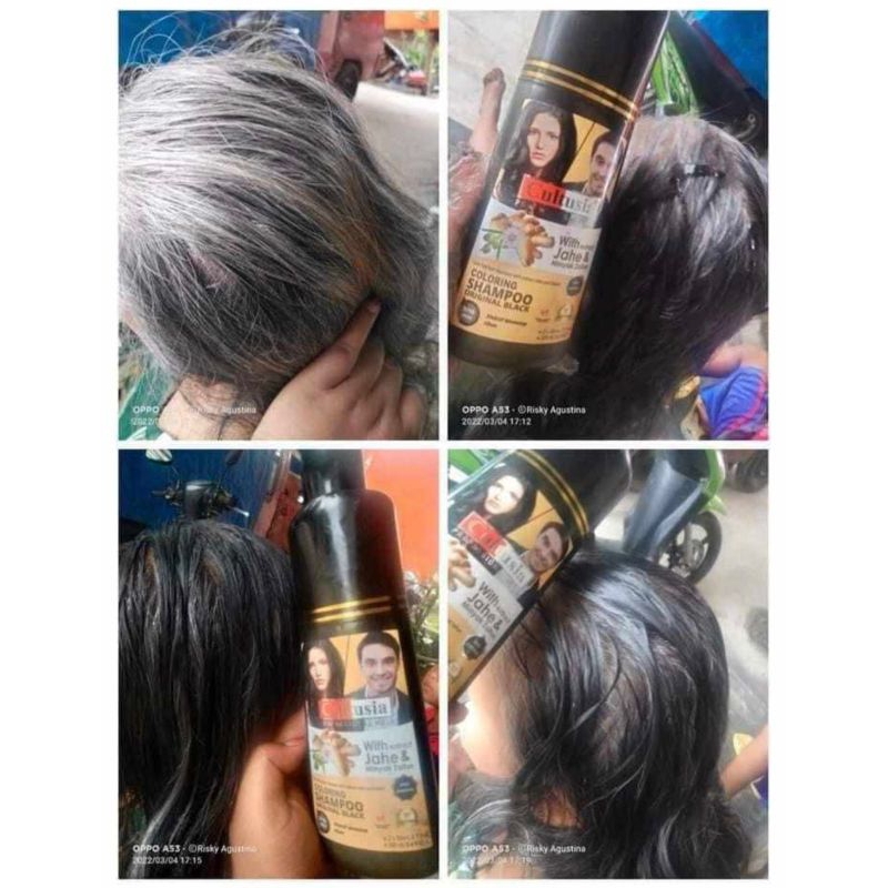 Jual SAMPO PENUTUP UBAN SECARA PERMANEN | Shopee Indonesia