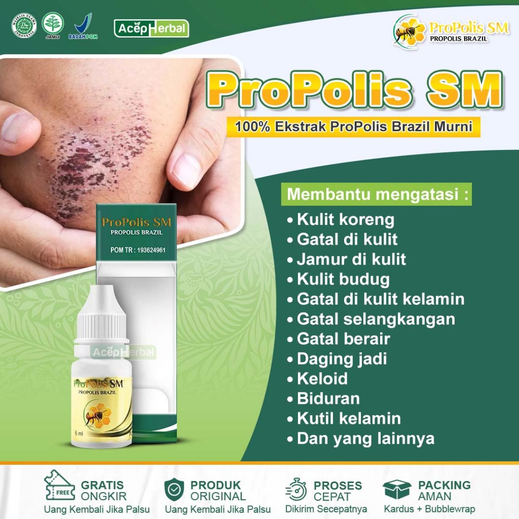 Jual Obat Koreng Di Kaki Penghilang Bekas Koreng Jamur Di Kulit Biduran ...