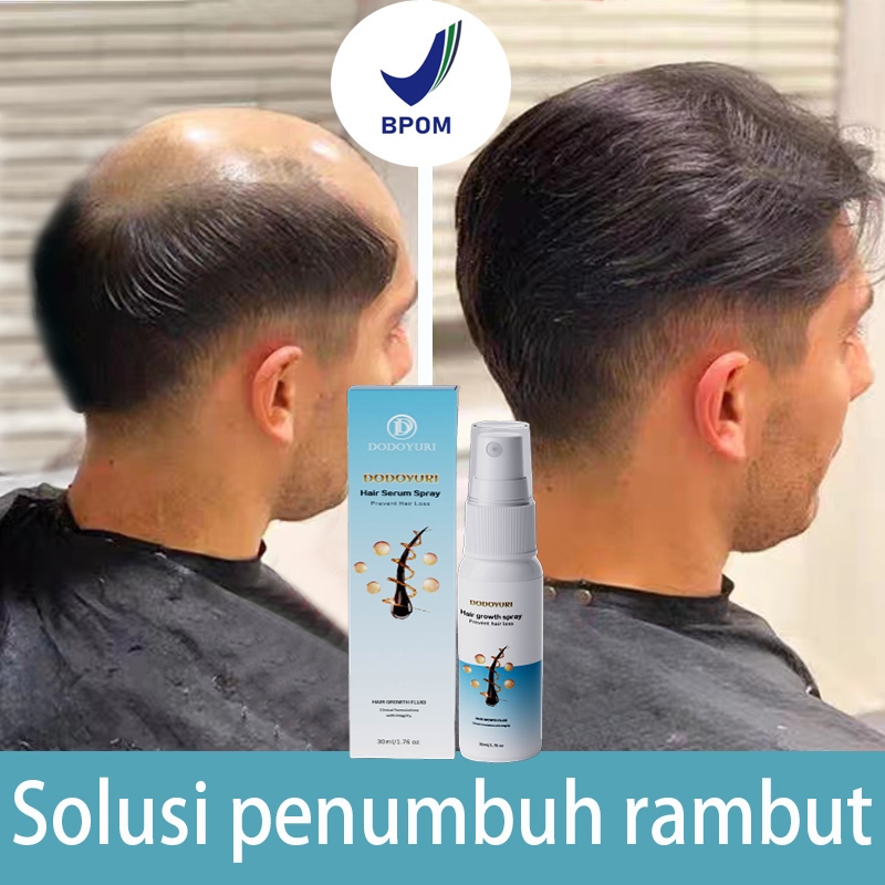 Jual [BPOM] Penumbuh rambut cepat obat penumbuh rambut serum penumbuh ...