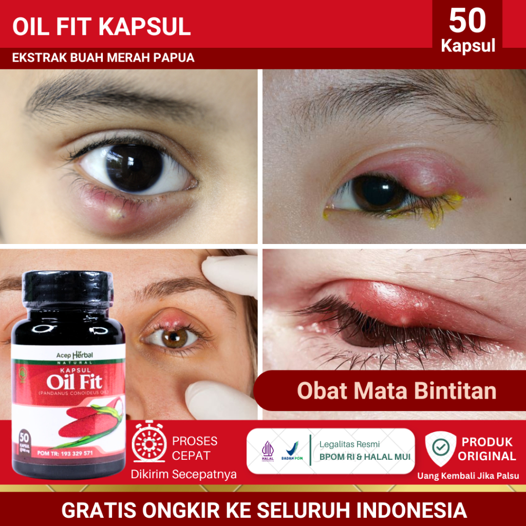 Jual Oil Fit 50 Kapsul - Obat Mata Bintitan, Benjolan Di Kelopak Mata ...