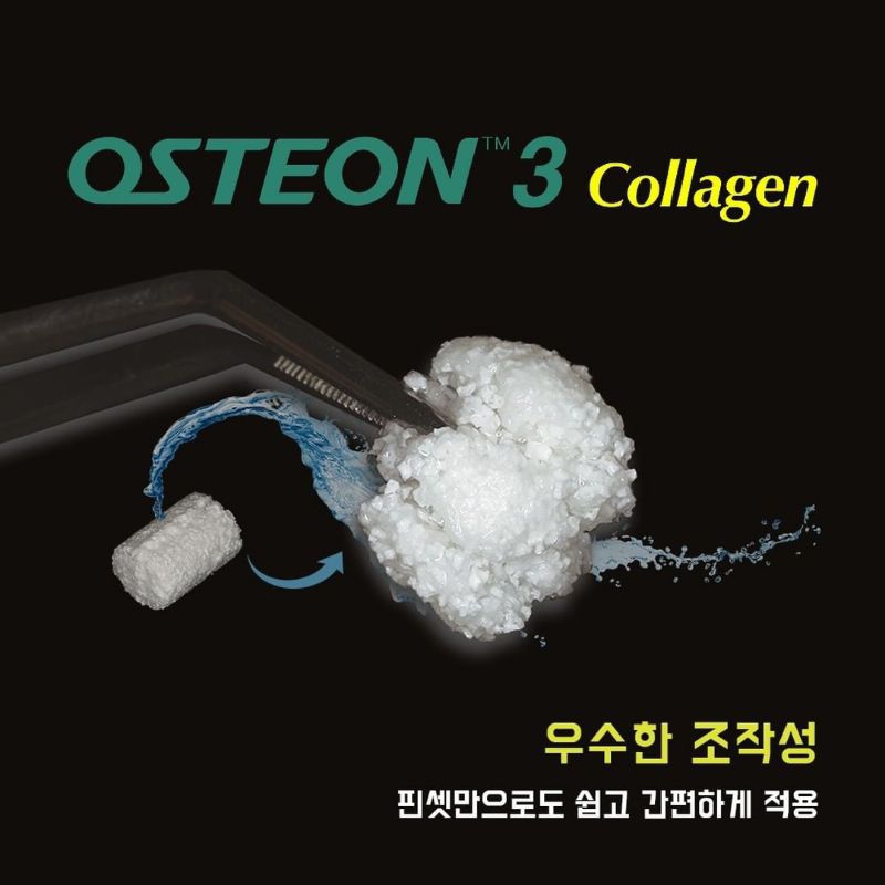 Jual Bond Graft Osteon III Collagen | Shopee Indonesia