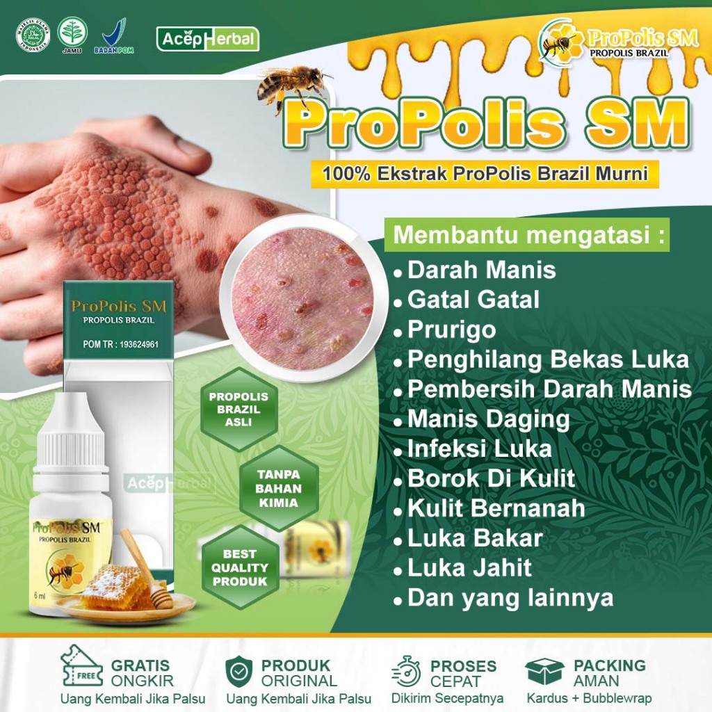 Jual Obat Darah Manis Prurigo Manis Daging Borok Di Kulit Kulit ...