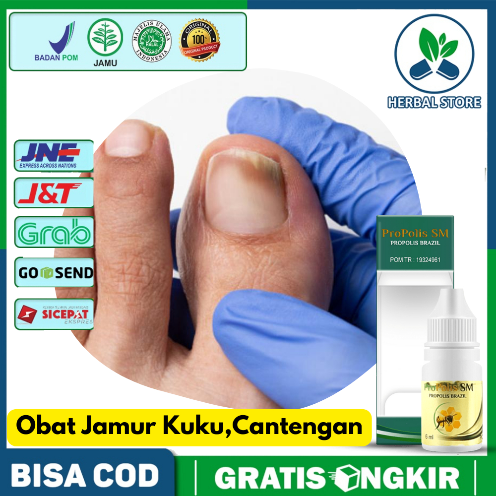 Jual Obat Jamur Kuku , Obat Cantengan Kaki dan Tangan, Jamur Kuku Rusak ...