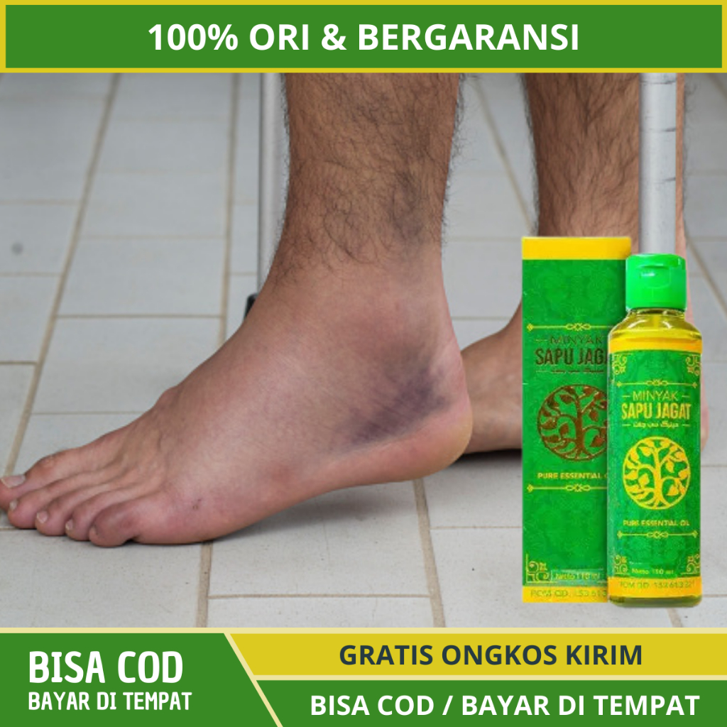 Jual Obat Kaki Bengkak Keseleo, Obat Pergelangan Kaki Bengkak, Obat ...