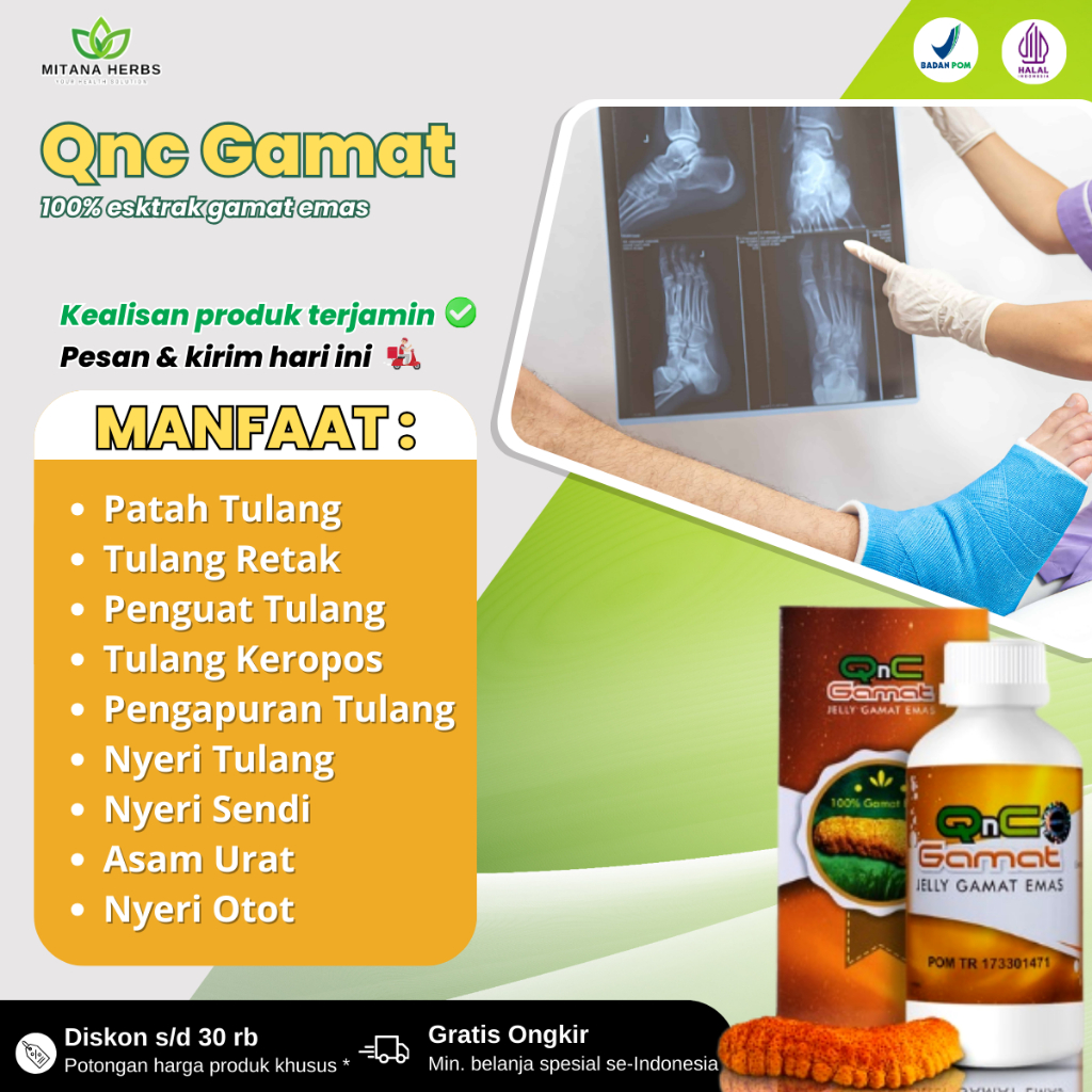 Jual Obat Patah Tulang Dan Retak Tangan Dan Kaki, Penguat Tulang, Patah ...