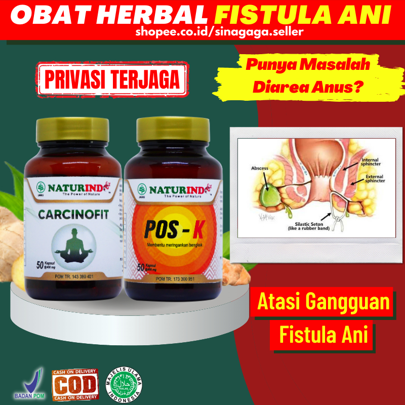 Jual Obat Herbal Fistula Vistula Ani Radang Infeksi Sakit Abses Anus ...