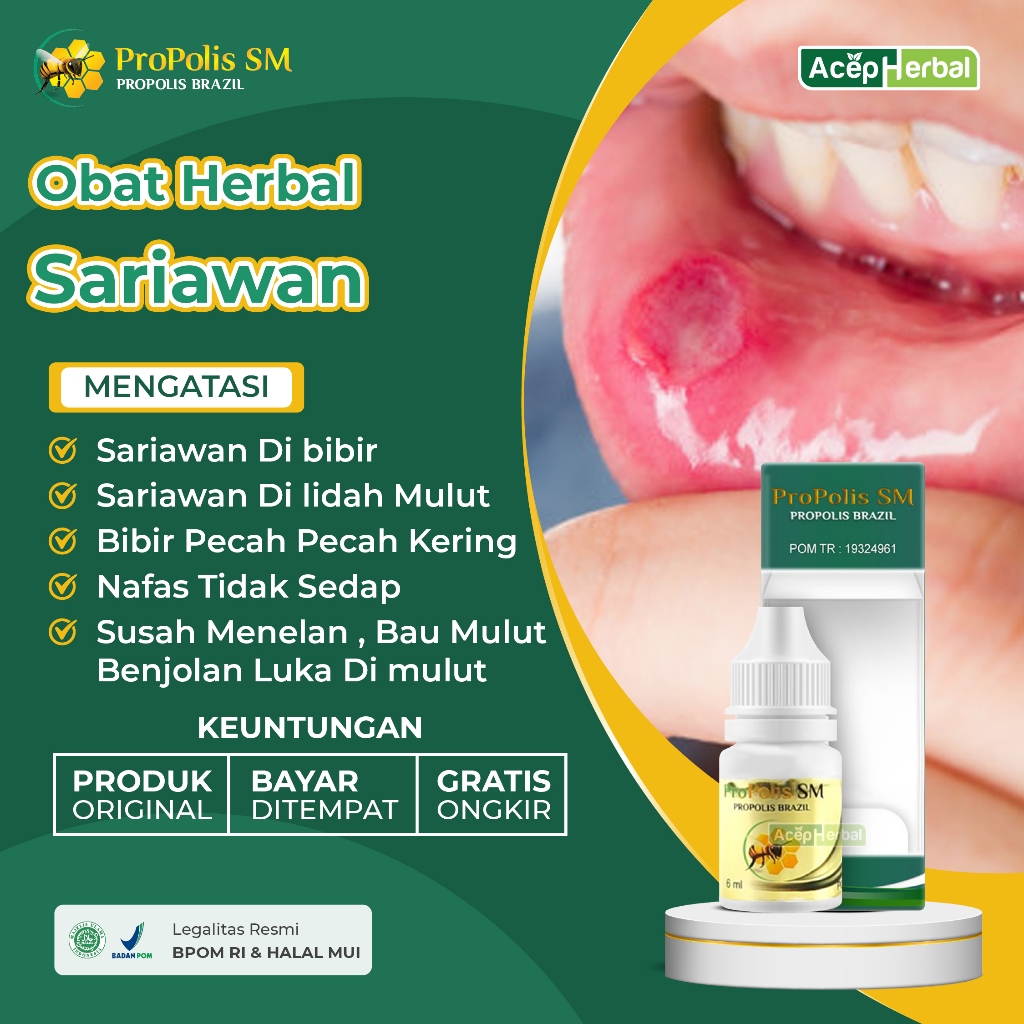 Jual Obat Sariawan Di Bibir Mulut Lidah Anak & Dewasa Bibir Pecah Pecah Dan Bibir Kering Panas ...