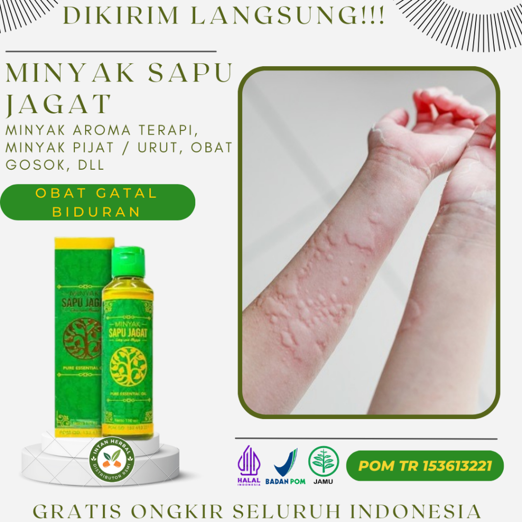 Jual Minyak Sapu Jagat 100% Original - Minyak Oles Untuk Gatal Biduran ...