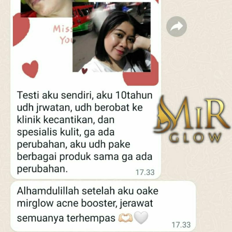 Jual Mir Glow Acne Glow Paket Basic (FREE GIFT) | Shopee Indonesia