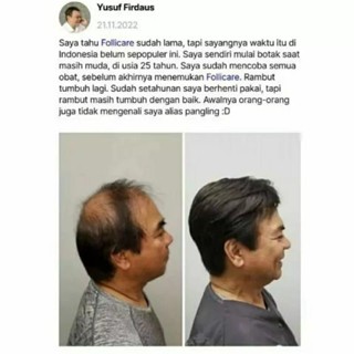 Jual FOLLICARE Asli Hair Serum Penumbuh Rambut Atasi Kebotakan Dan ...