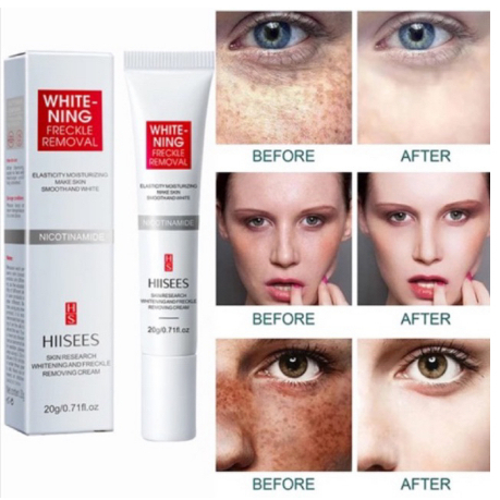 Jual HIISEES Freckle Whitening Cream Drak Spot - Menghilangkan Bekas ...