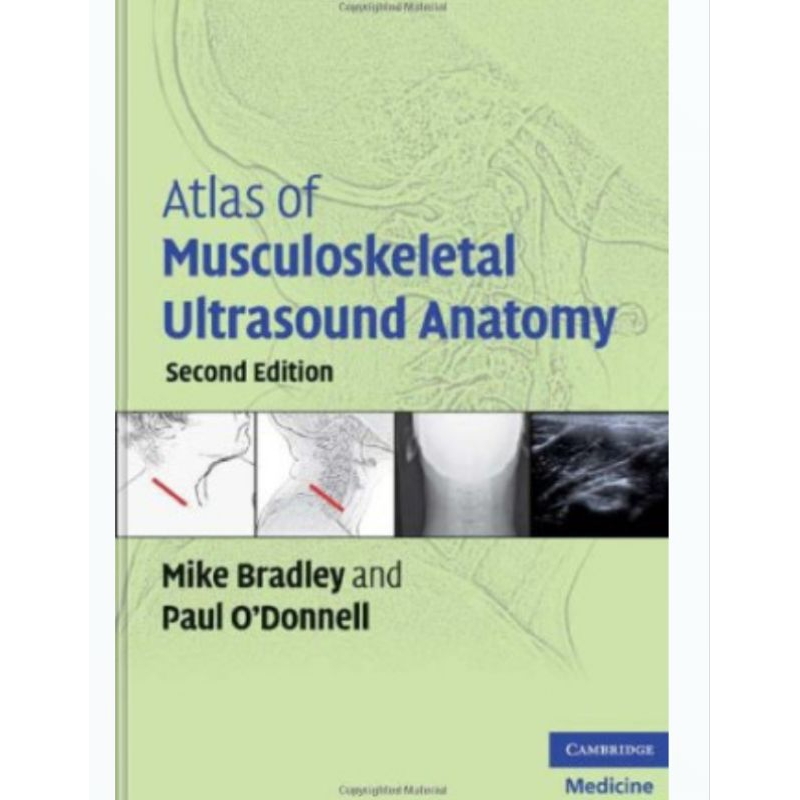 Jual Buku Atlas of Musculoskeletal Ultrasound Anatomy | Shopee Indonesia