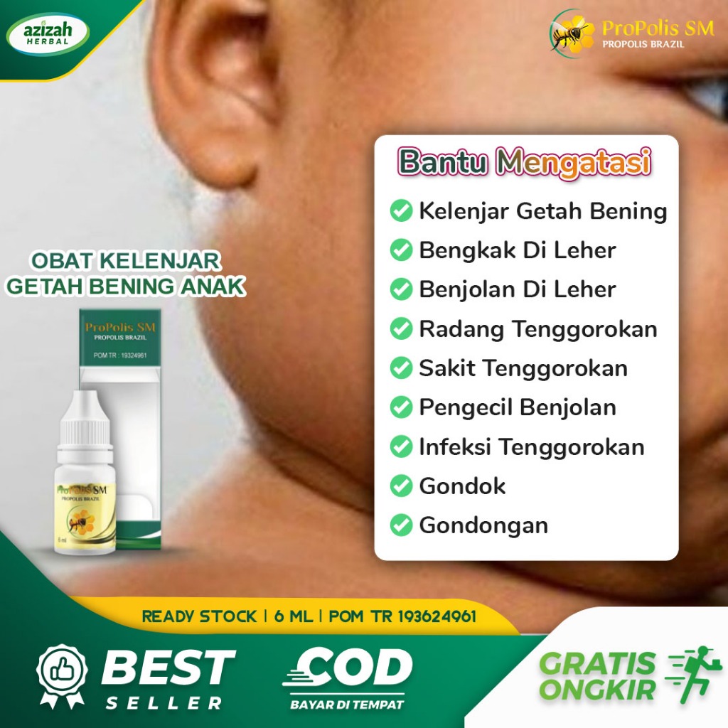 Jual Obat Kelenjar Getah Bening Anak Gondok Gondongan Bengkak Benjolan ...