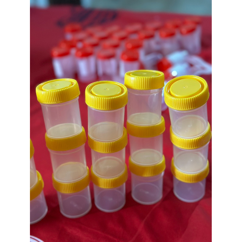 Jual POT FESES 60ml / 60cc POT URINE Stool Container OneMed | Shopee ...