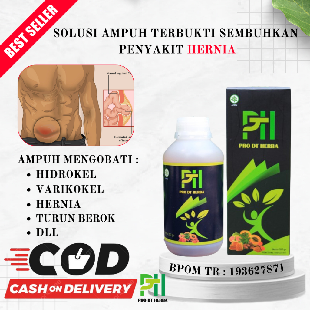 Jual Obat Hernia Paling Ampuh Hernia Anak Dan Dewasa Usus Turun ...