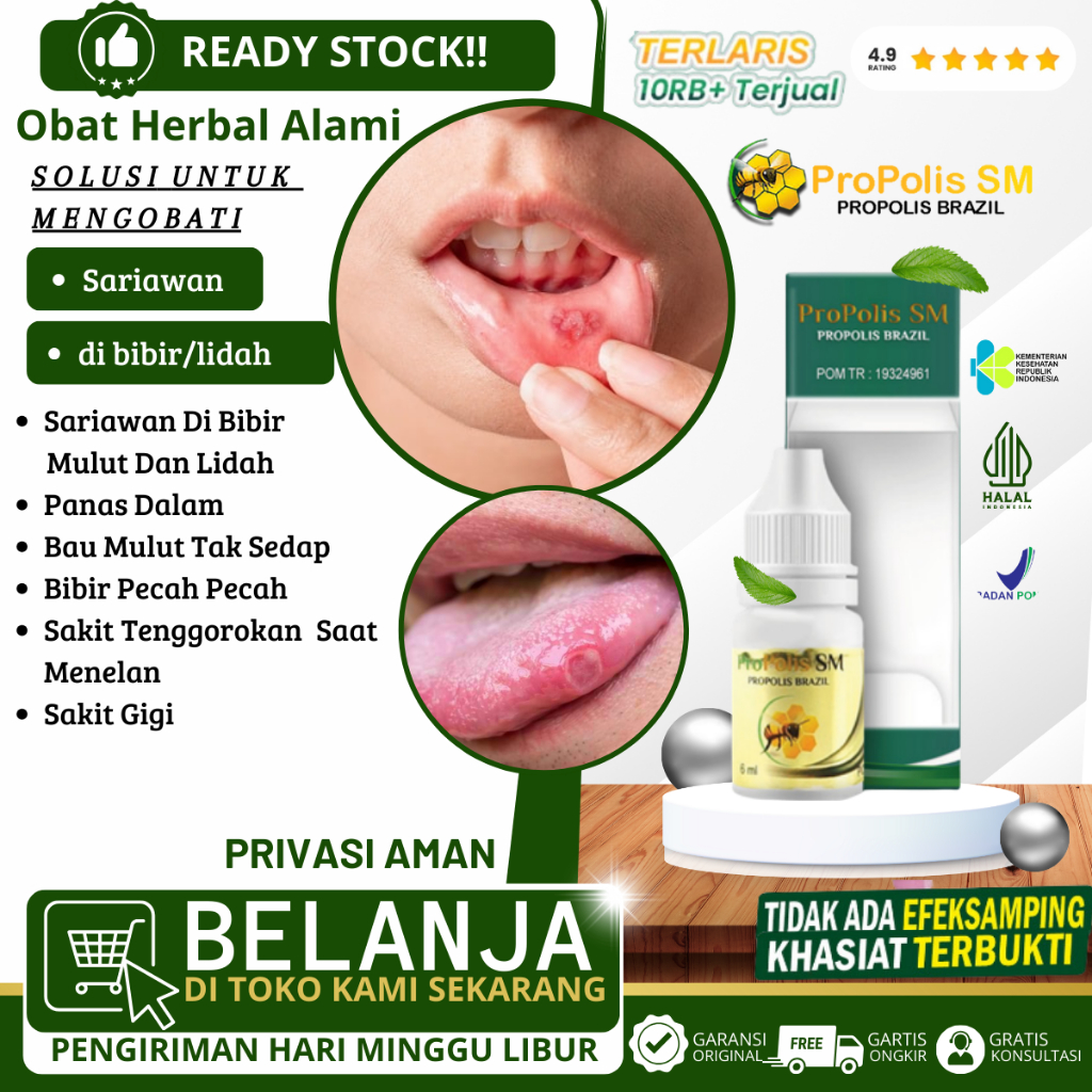 Jual Obat Sariawan Di Bibir Mulut Dan Lidah Panas Dalam Atasi Bau Mulut ...
