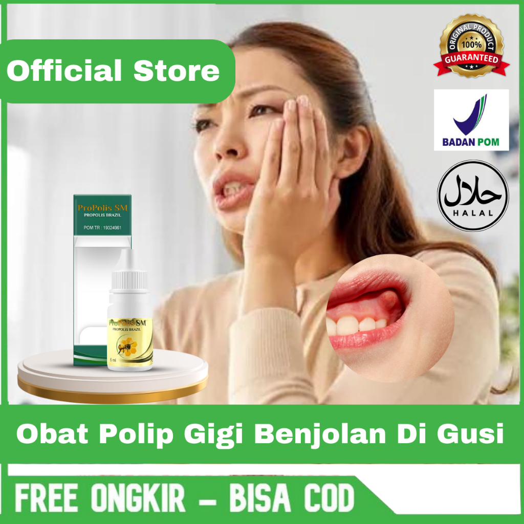 Jual Obat Polip Gigi Benjolan Di Gusi, Sakit Gigi Berlubang, Gusi ...