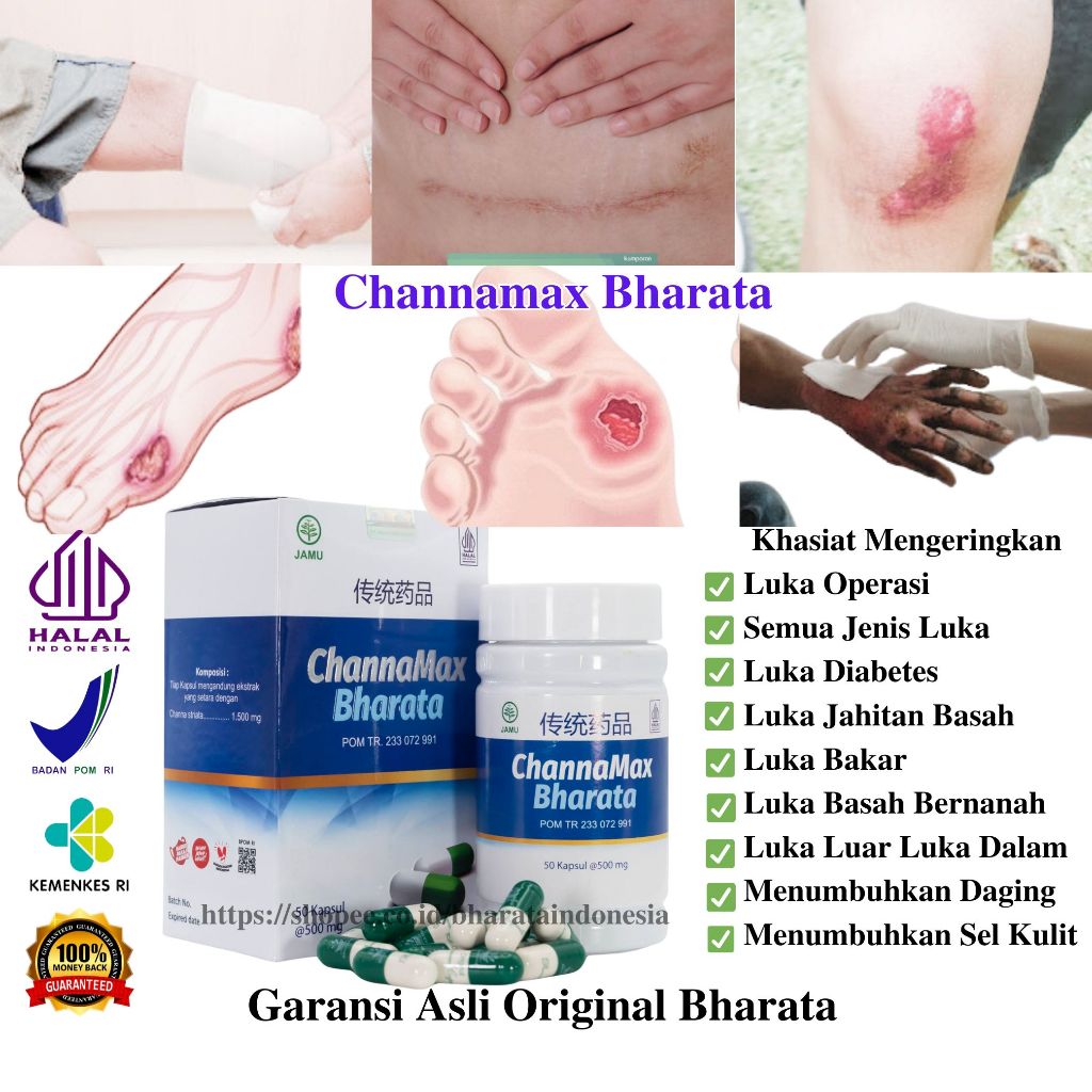 Jual Obat Luka Basah Bernanah Agar Cepat Kering Ampuh CHANNAMAX BHARATA ...