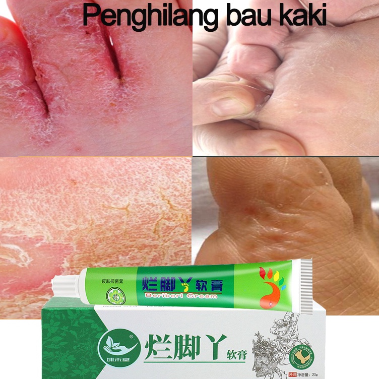 Jual Pusat Jual Bau kaki Obat krim eksim Salep anti gatal 2g gatal gatal Obat kaki berkeringat ...
