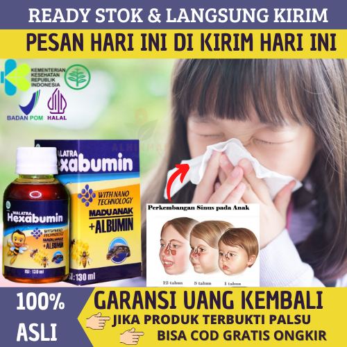 Jual Obat Sinusitis Anak, Obat Alergi Rhinitis, Obat Alergi Bersin ...