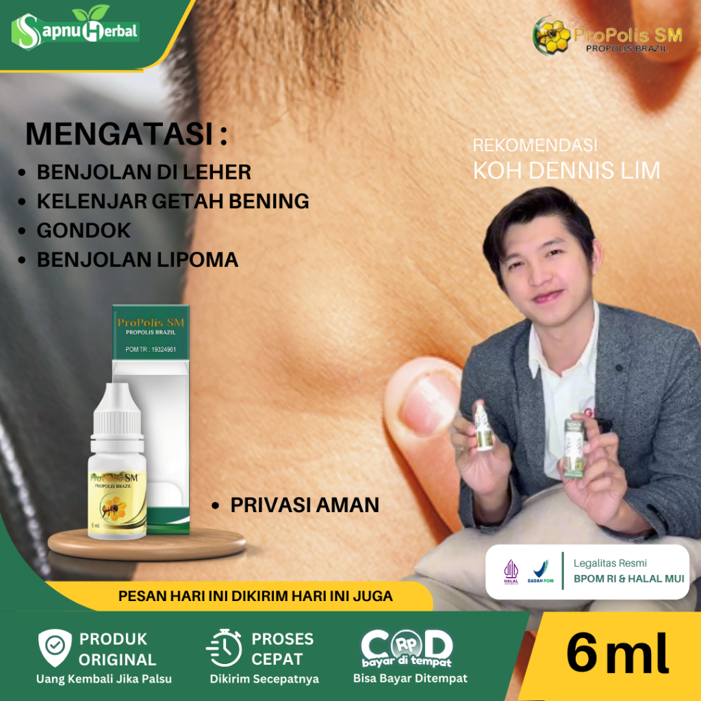 Jual Obat Benjolan Lipoma, Penghancur Benjolan di Tubuh, Benjolan Di ...