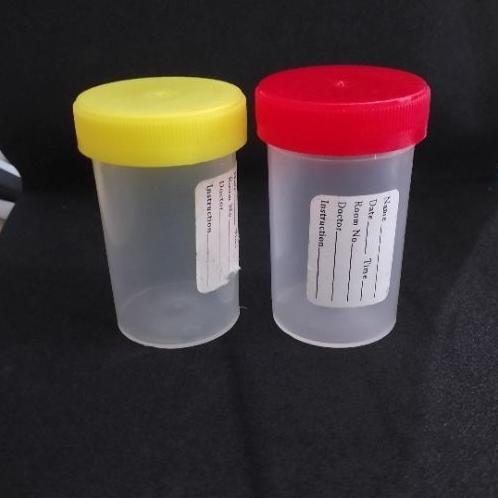 Jual Botol ukuran 60 ml - Untuk Sample Laboratorium dll | Shopee Indonesia