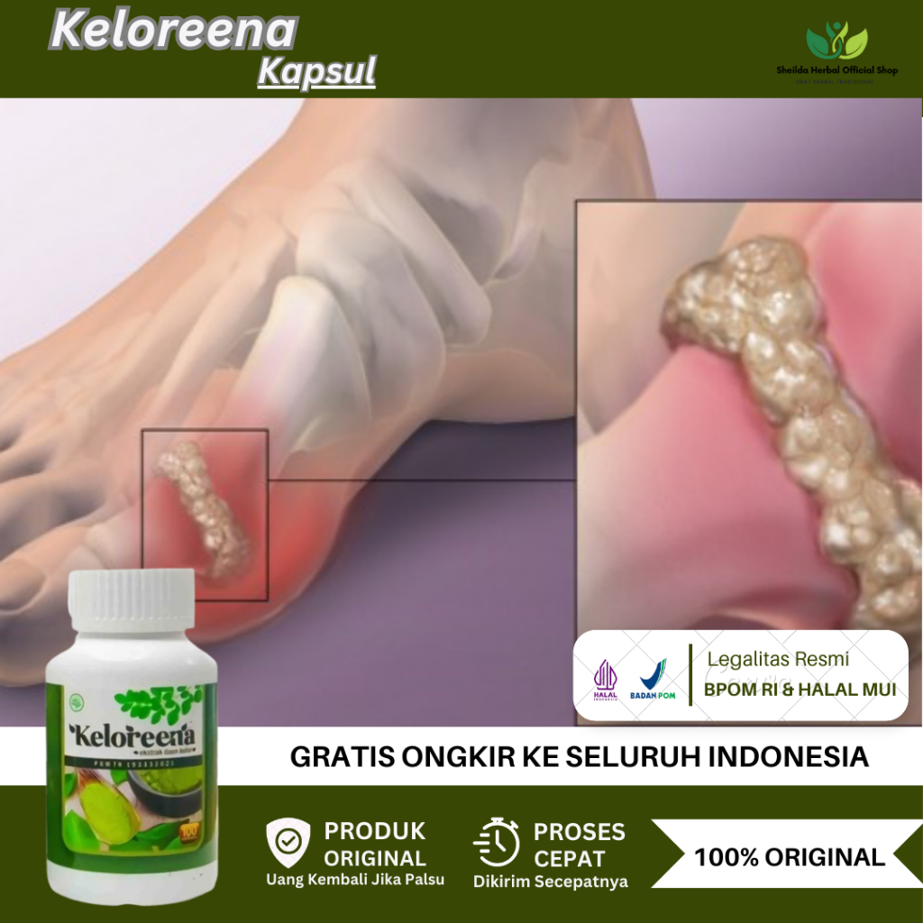 Jual Keloreena - Obat Atasi Asam Urat Rematik, Urat Bengkak, Nyeri ...