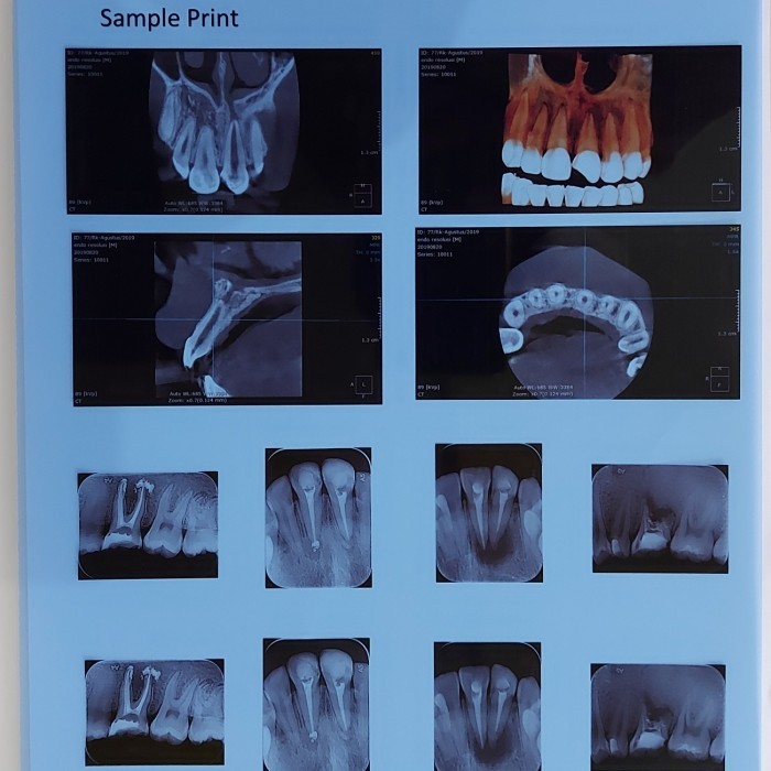 Jual Medical Blue Film for Inkjet Printer/ Dry Medical X ray Film ...