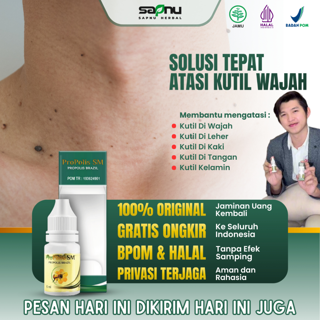 Jual Obat Skin Tag, Obat Penghilang Skin Tag, Obat Perontok Kutil, Obat ...