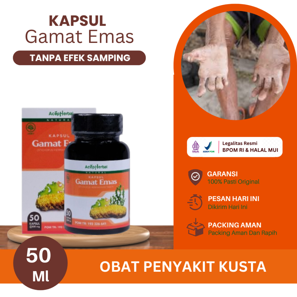 Jual Obat Penyakit Kusta, Kusta Mati Rasa, Kusta Bunga, Kusta Kering ...