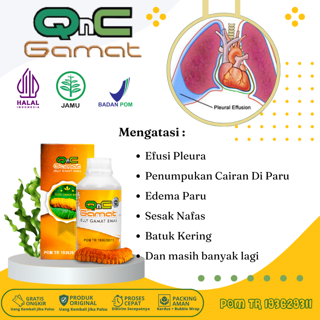 Jual Obat Penumpukan Cairan Di Paru-Paru, Edema Paru, Sesak Nafas ...
