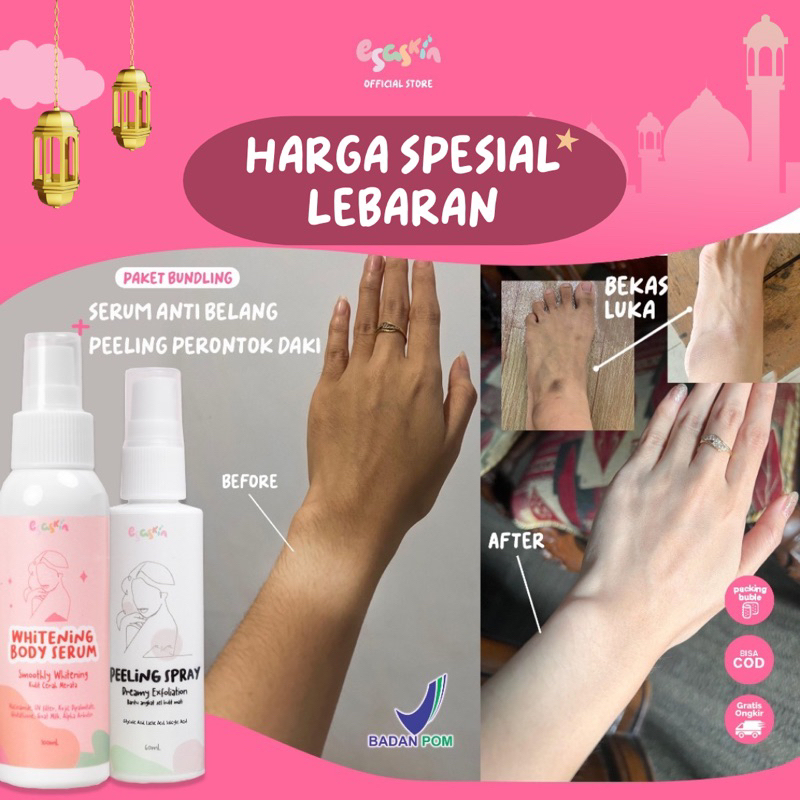 Jual ESASKIN - Peeling Spray dan Body Serum | Shopee Indonesia