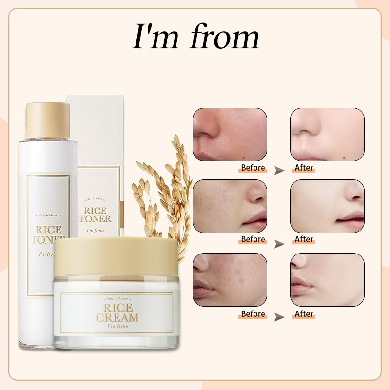 Jual I'm From Rice Toner 150ml / I'm From Rice Cream 50ml 77,78% ...