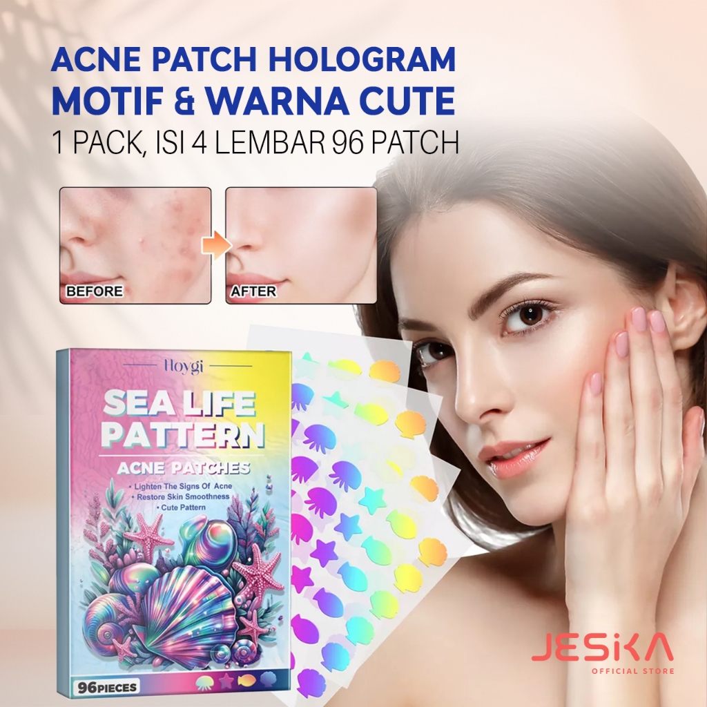 Jual Acne patch hologram eelhoe tea tree oil untuk jerawat karakter ...