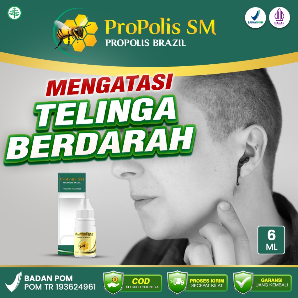 Jual Propolis SM Obat Telinga Berdarah Gendang Telinga Pecah Berair Bernanah Radang Curek ...