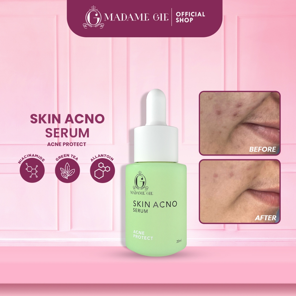 Jual Madame Gie 5% Niacinamide Skin Acno Serum - Skincare | Shopee Indonesia