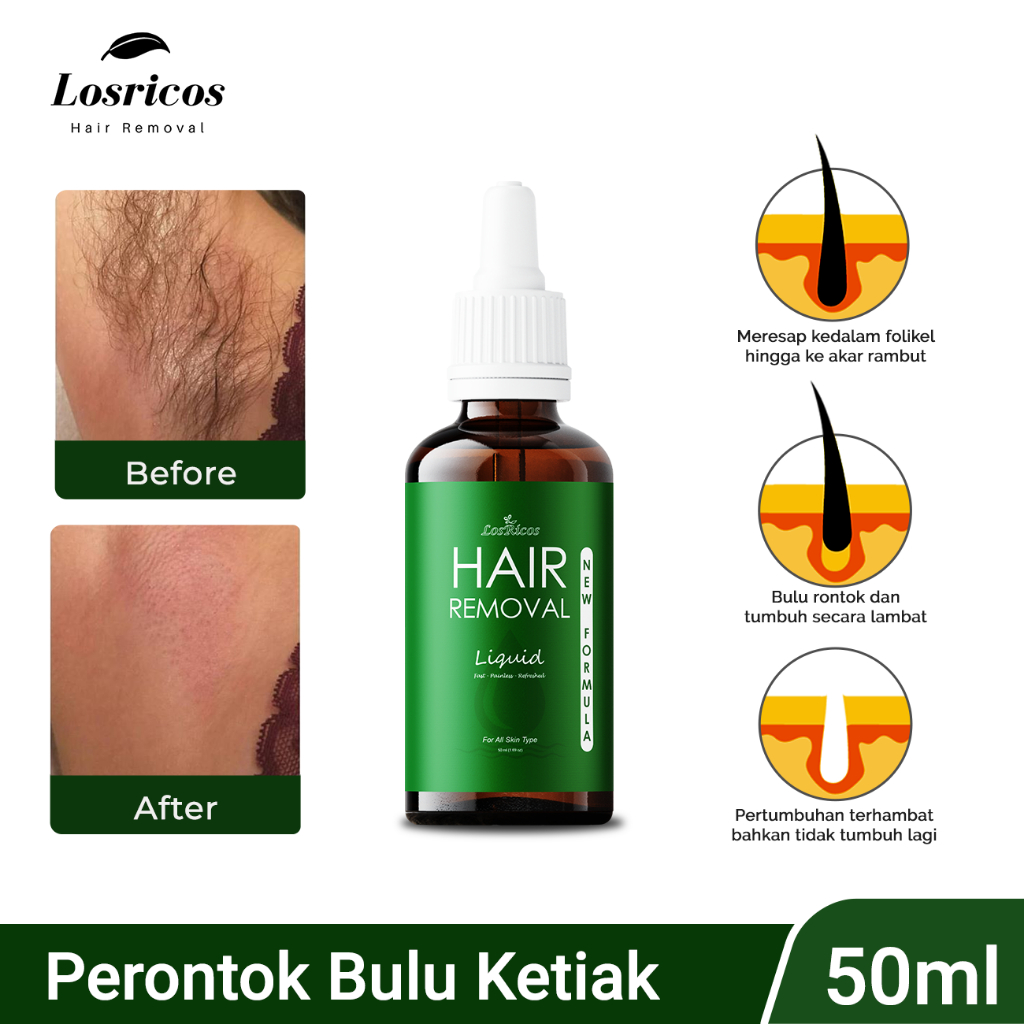 Jual Cream Wax Perontok Bulu Ketiak Permanen Losricos Hair Removal ...