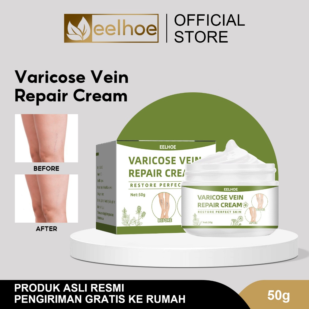 Jual 【Beli 3 Gratis 2】EELHOE Varicose Veins Cream 50g Obat Varises ...