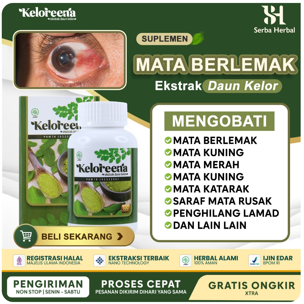 Jual Obat Mata Berlemak, Pembersih Pterigium, Pterygium, Penghilang ...