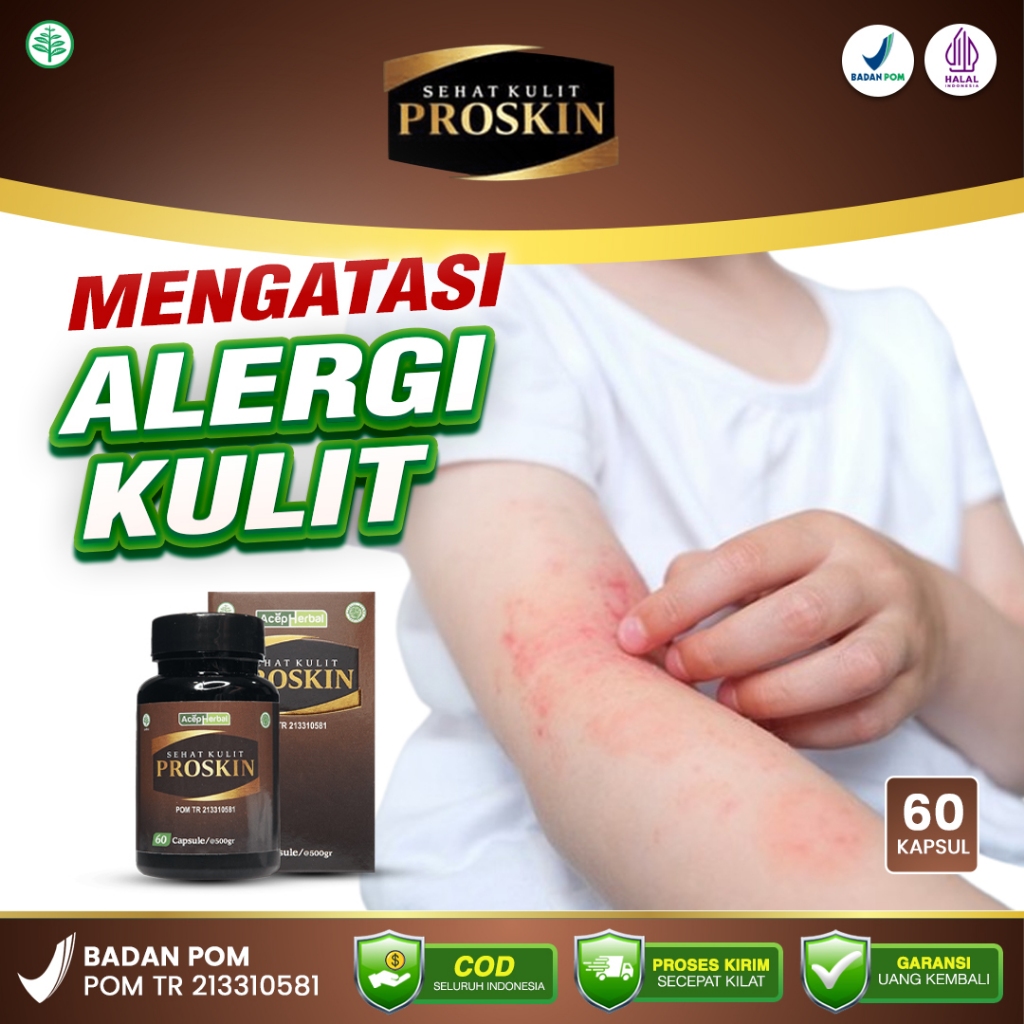 Jual Suplemen Herbal Proskin 100% Original - Obat Alergi Kulit Ekzema ...