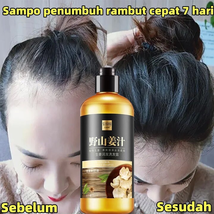 Jual [100% Asli] Shampo Penumbuh Rambut Cepat Ginger Shampoo Botak ...