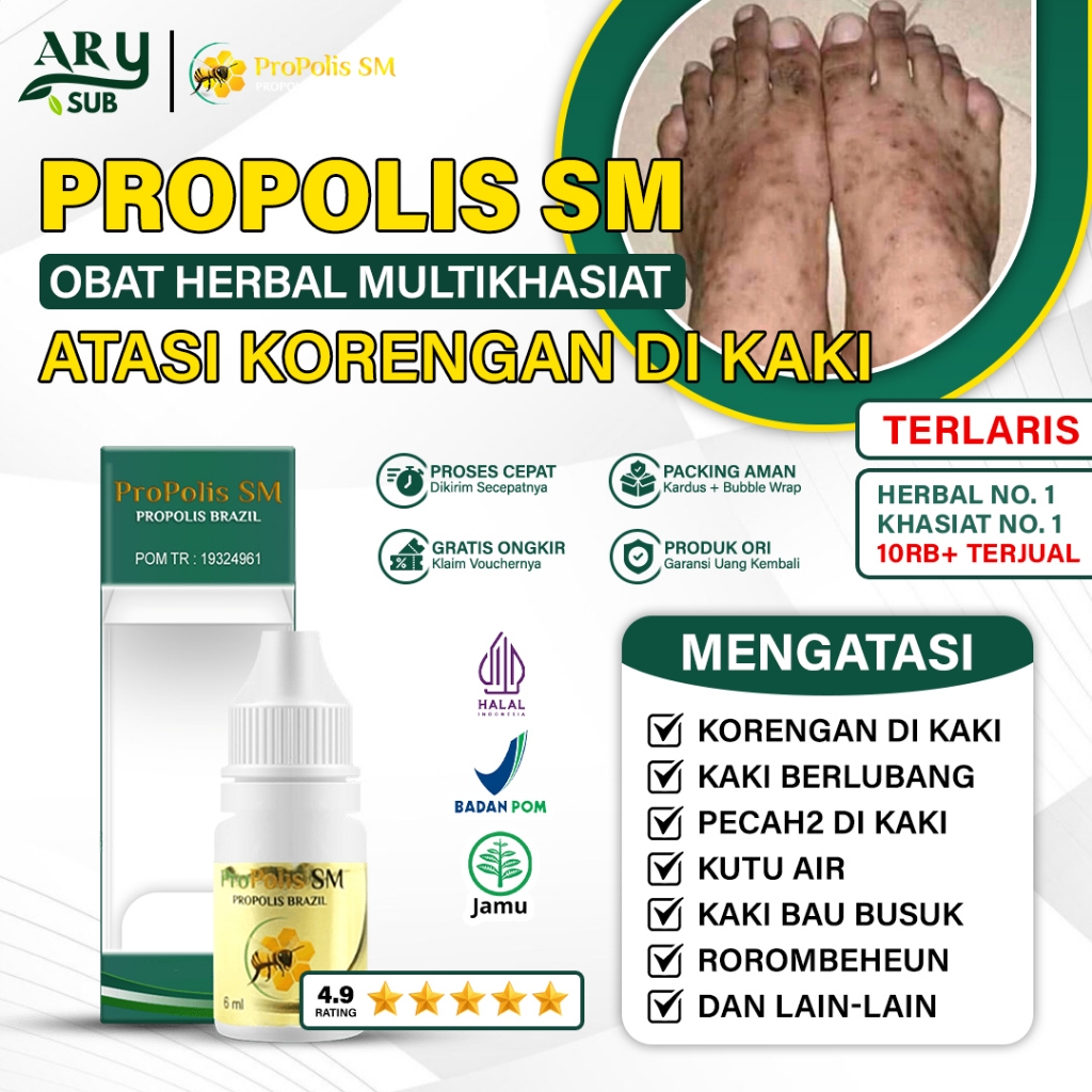 Jual Obat Korengan di Kaki - Korengan di Kepala - Korengan di Wajah ...