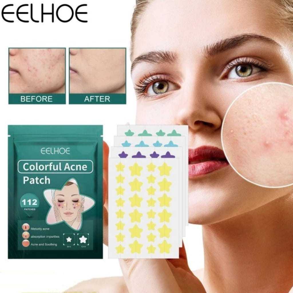 Jual Acne Patch Karakter Pimple Patch Star Merah Jambu Hijau Ungu Biru ...